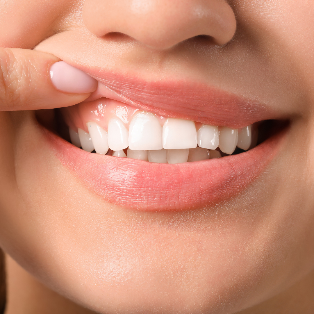 How Stress Impacts Your Teeth and Gums — Dr Nidhi Berera