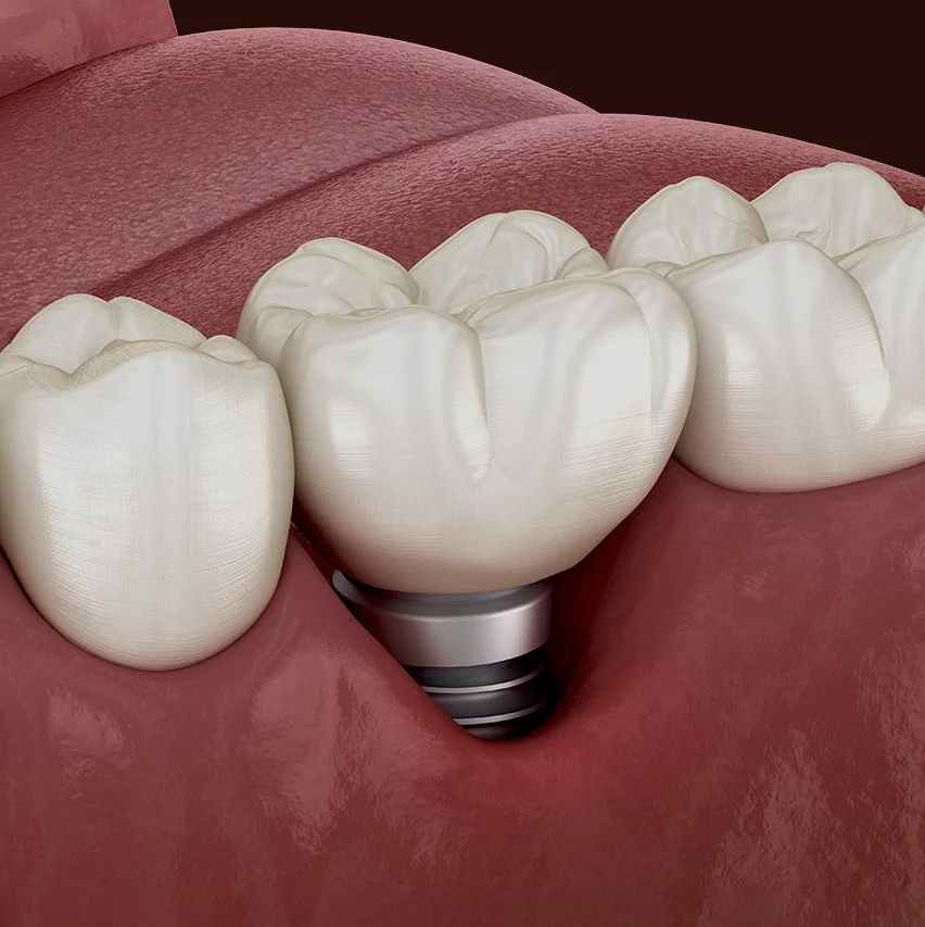 Oral Surgery treatments by Dr Maria Devine at the clinics in London ...