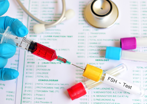 Perimenopause and follicle stimulating hormone (FSH) – why your level ...