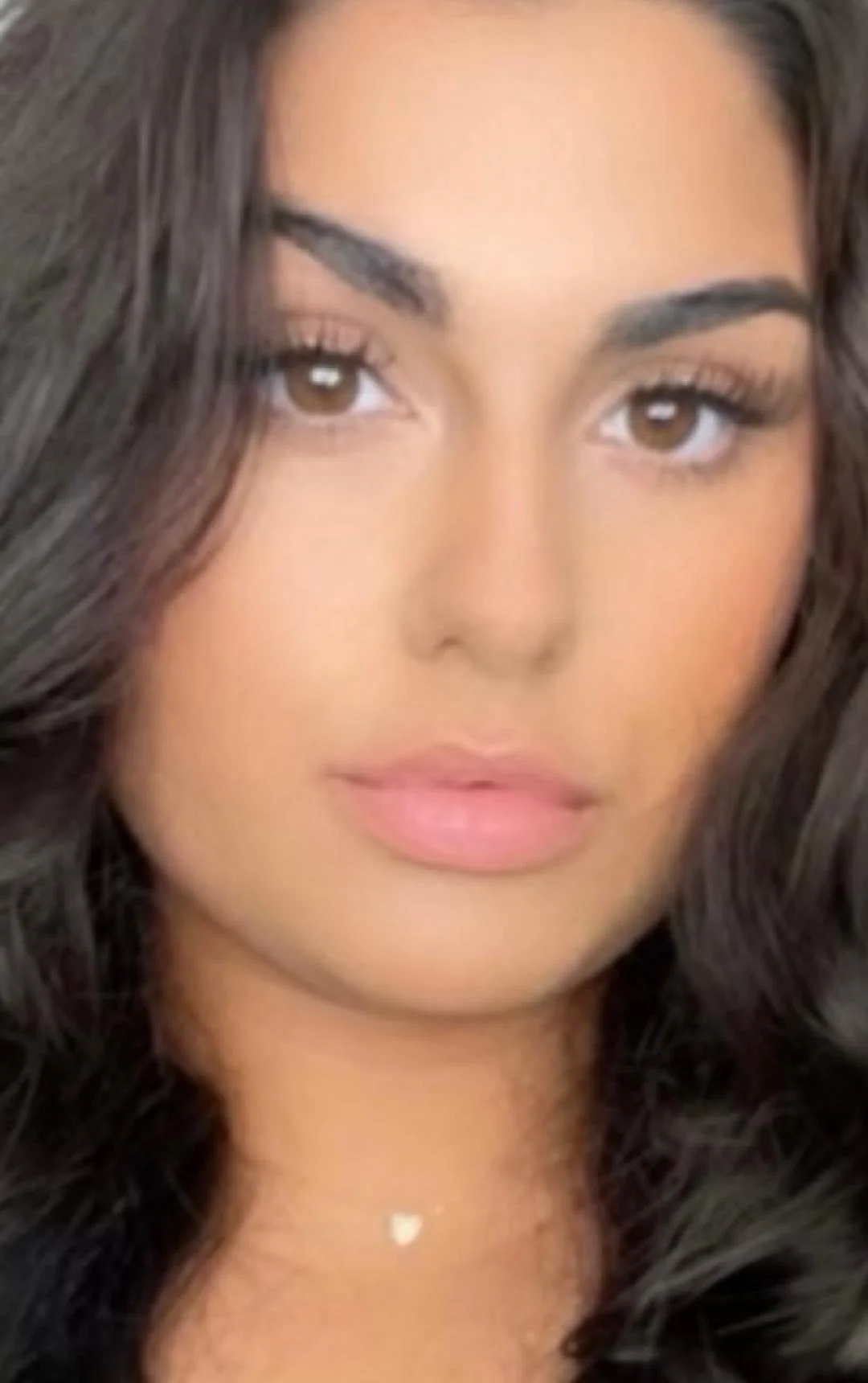 Des Plaines Medspa | Edison Park Medical Spa | Aesthetic Angels Beauty Bar