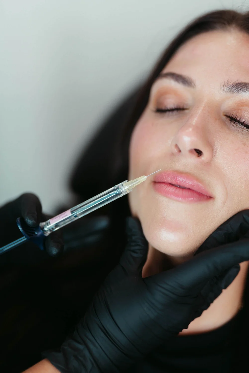 Restylane & Juvederm Dermal Fillers in Scottsdale, AZ