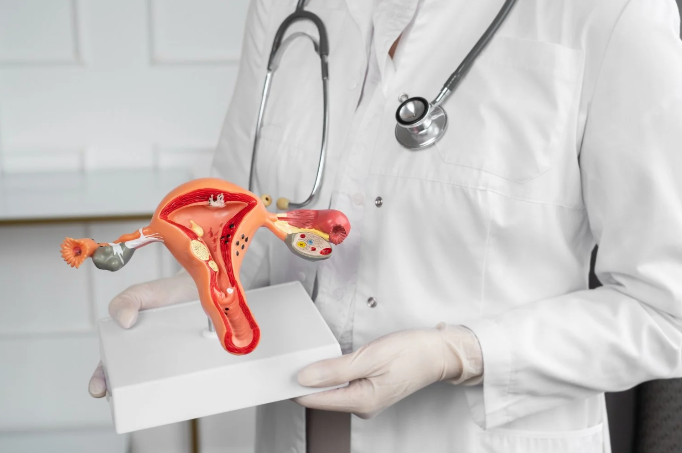 Endometrial Biopsy — Ceibo Fertility Center