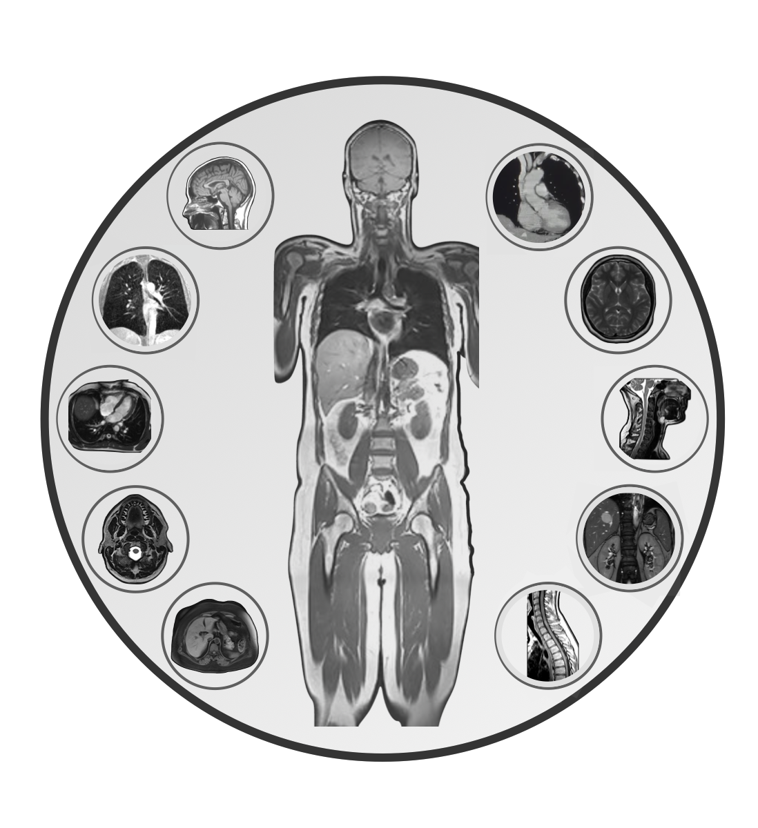 Full Body MRI Screenings