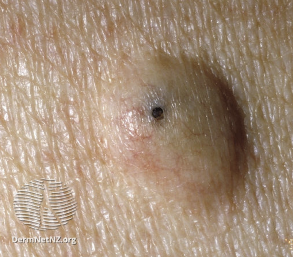 6 vulvar skin issues and what to do about them! — Female Health Education