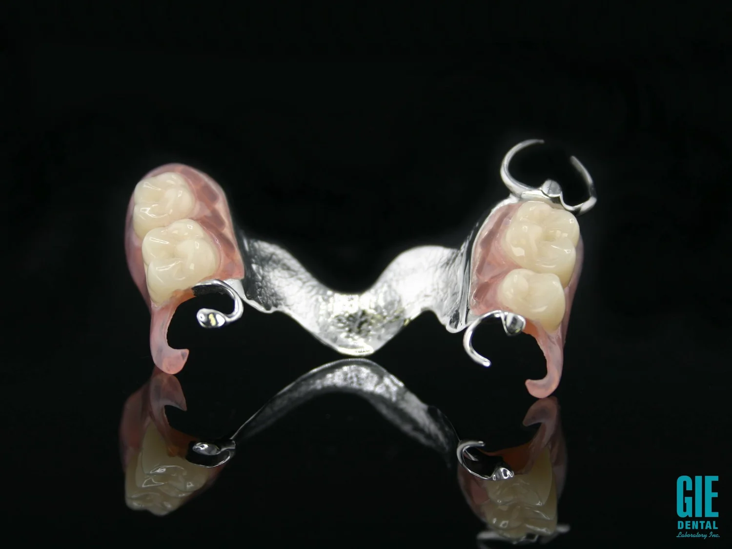 Hybrid Partial Denture | Enhance Your Smile Today — GIE Dental Lab ...