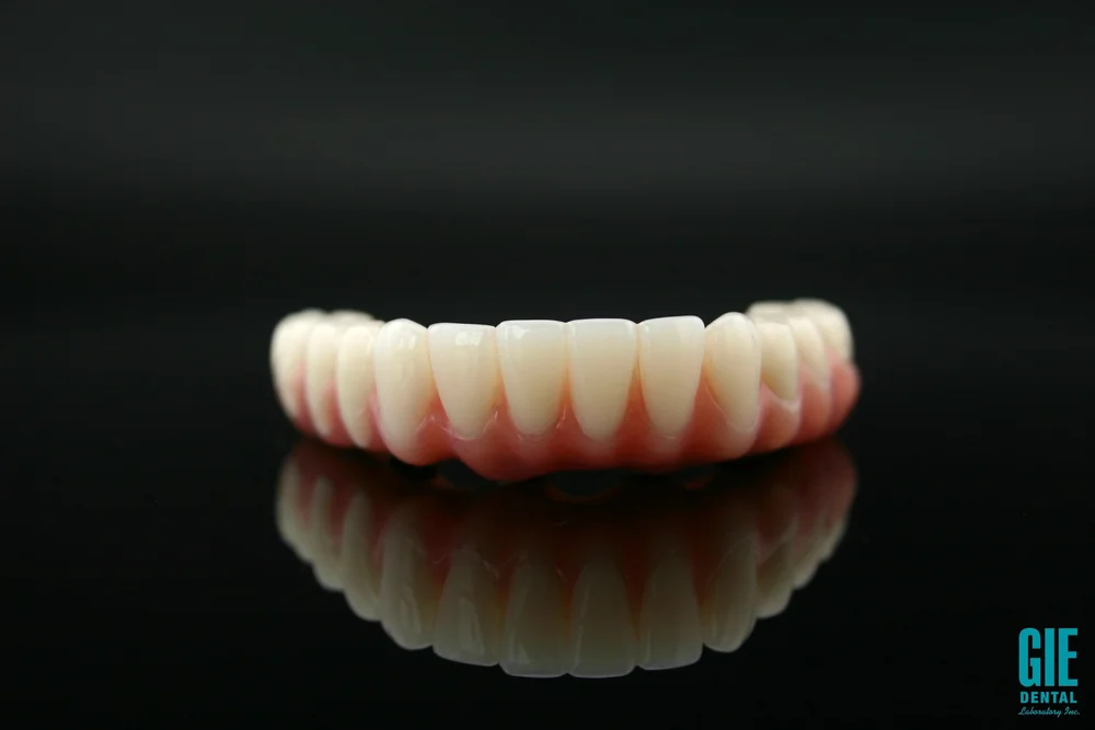 Hybrid Fixed Denture with Substructure | Enhance Your Smile Today ...