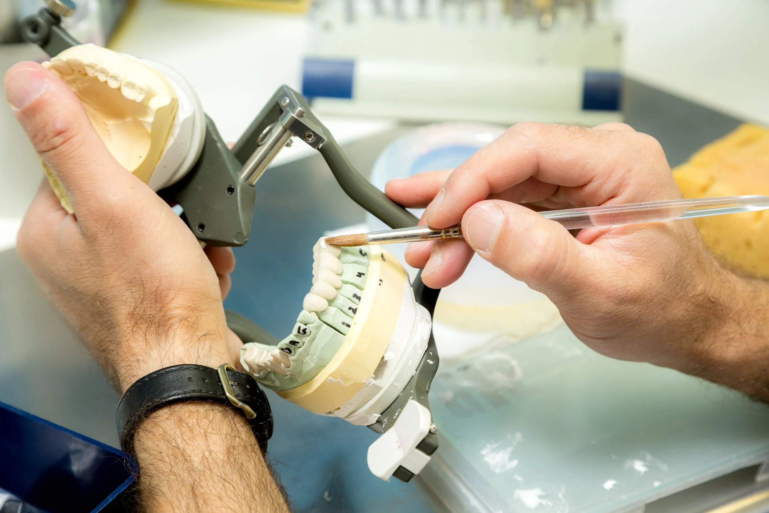 Digital Cases | Enhance Your Smile Today — GIE Dental Lab | Los Angeles ...