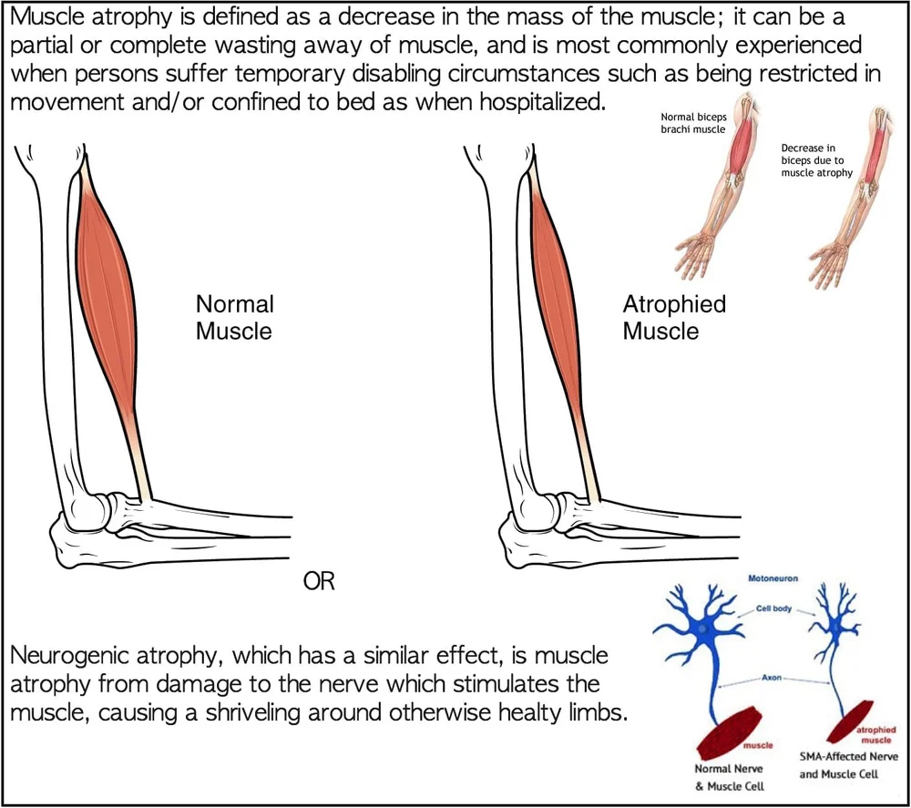 Saddle Damage Part 1 – Myths of Muscle Atrophy — Saddlery Solutions