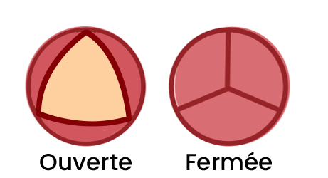 Sténose aortique — Heart Valve Voice Canada