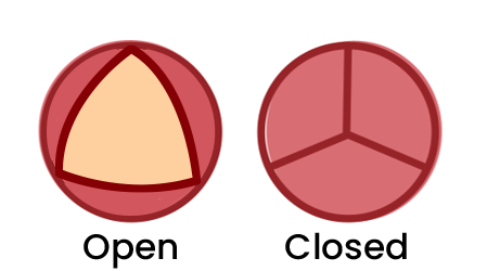Heart valve disease overview — Heart Valve Voice Canada