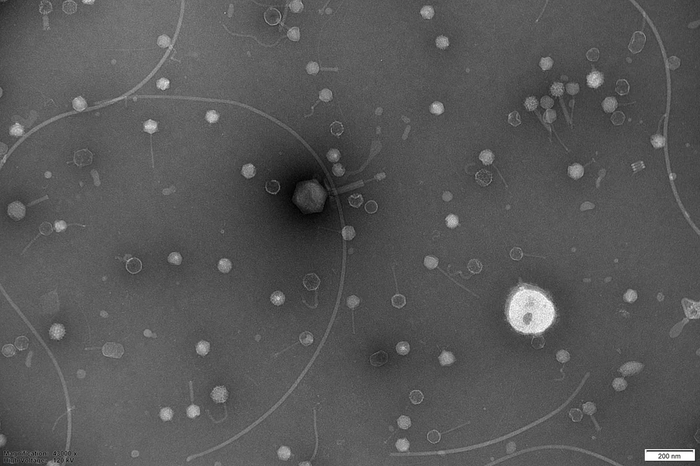 What are phages? | Discover and Fight Bacteria Today ...
