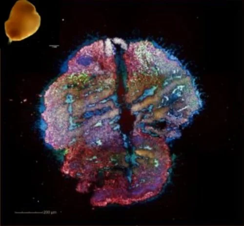 What We Do — Kathuria Lab