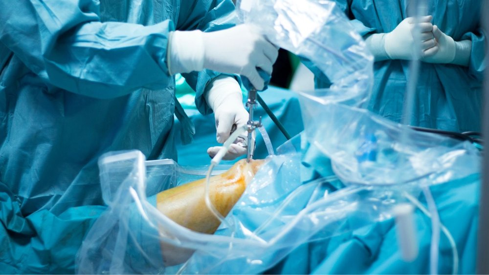 Orthopaedic Surgery | Schedule Expert Orthopaedic Care — Unify Health