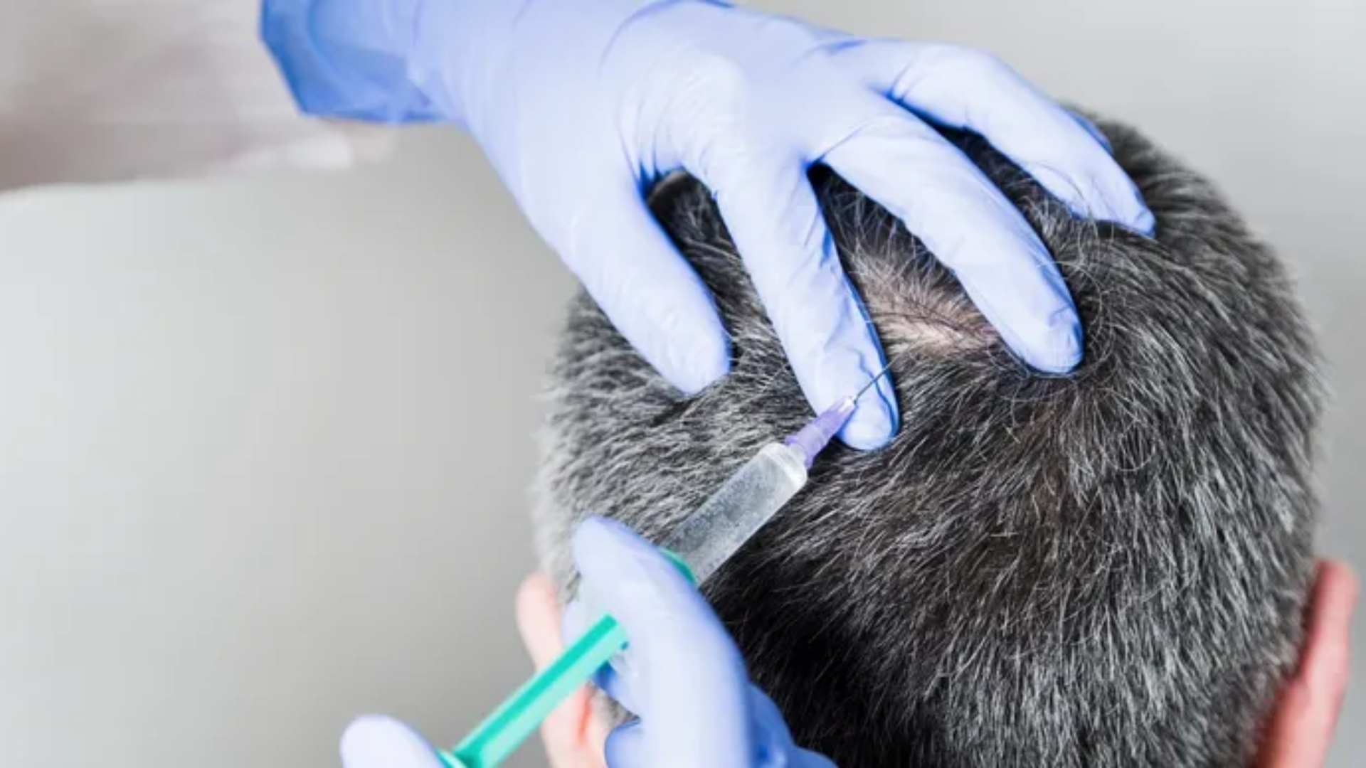 Hair Loss Program — Unify