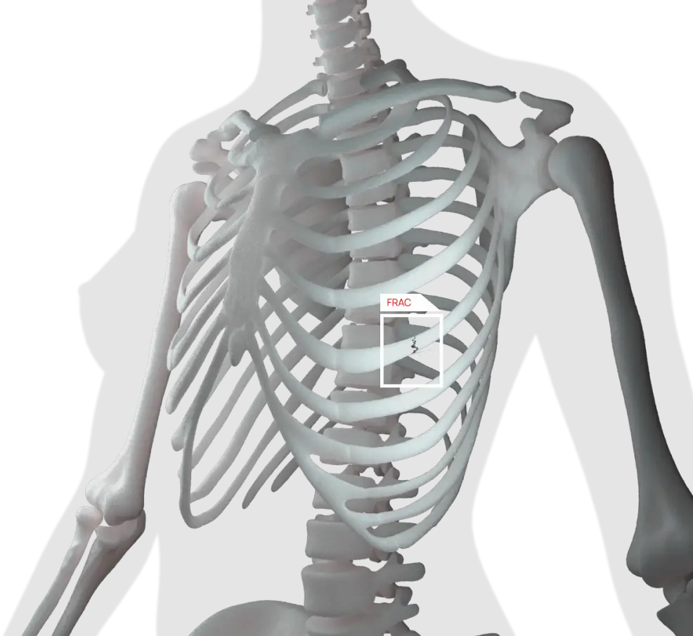 AZmed: AI Chest detection — intellimed