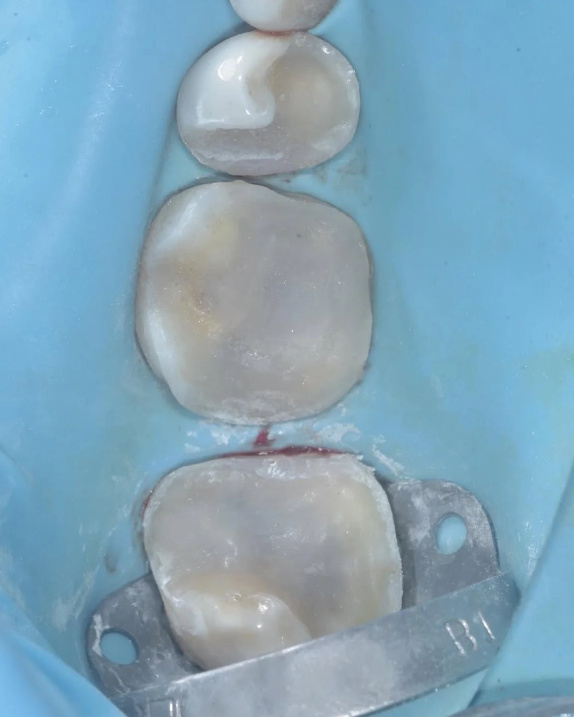 The Alleman Center Articles — Alleman Center of Biomimetic Dentistry