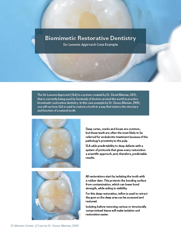 Free Biomimetic Dentistry Case Example — Alleman Center of Biomimetic ...