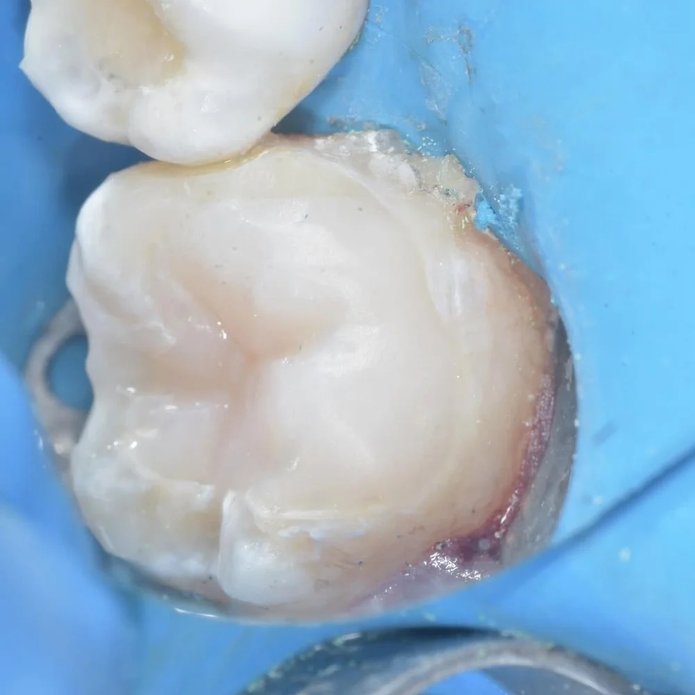 Is Biomimetic Dentistry Worth It? — Alleman Center of Biomimetic Dentistry
