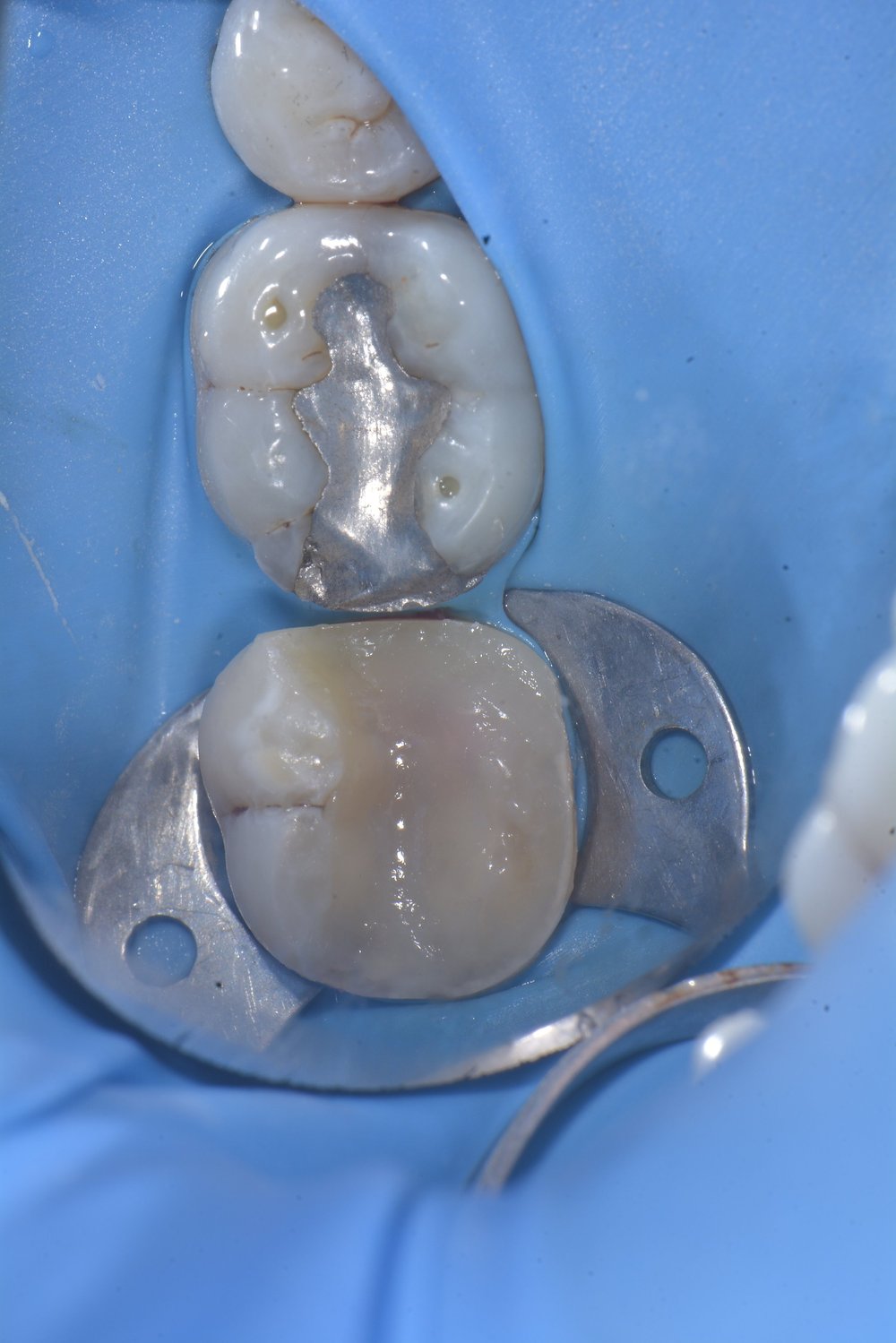 Art, Science and Dentistry — Alleman Center of Biomimetic Dentistry