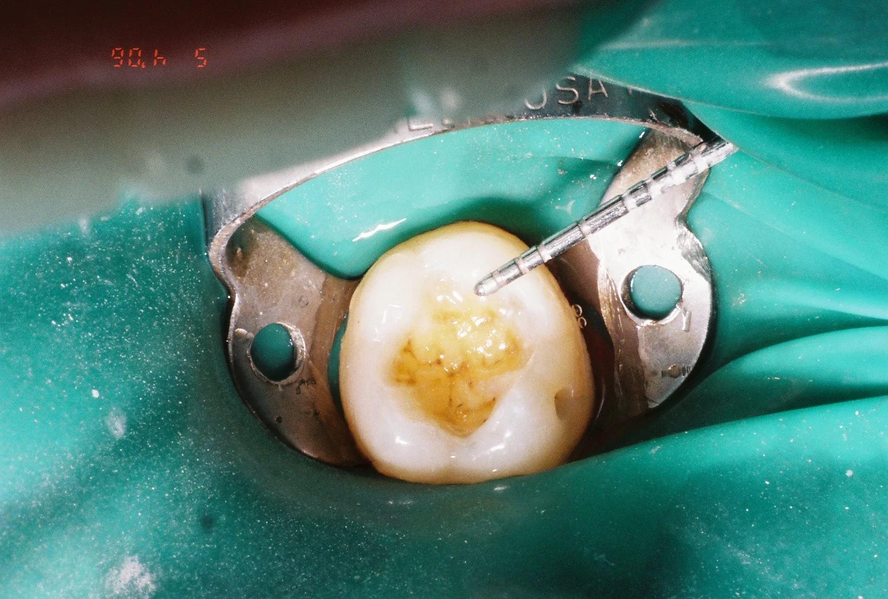 Biomimetic Mastership — Alleman Center of Biomimetic Dentistry
