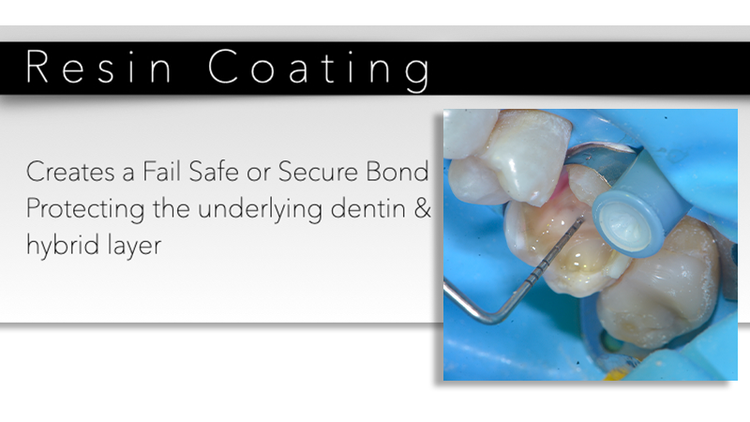 The Hybrid Layer (HL) - The Essential Bond in Restorative Dentistry ...