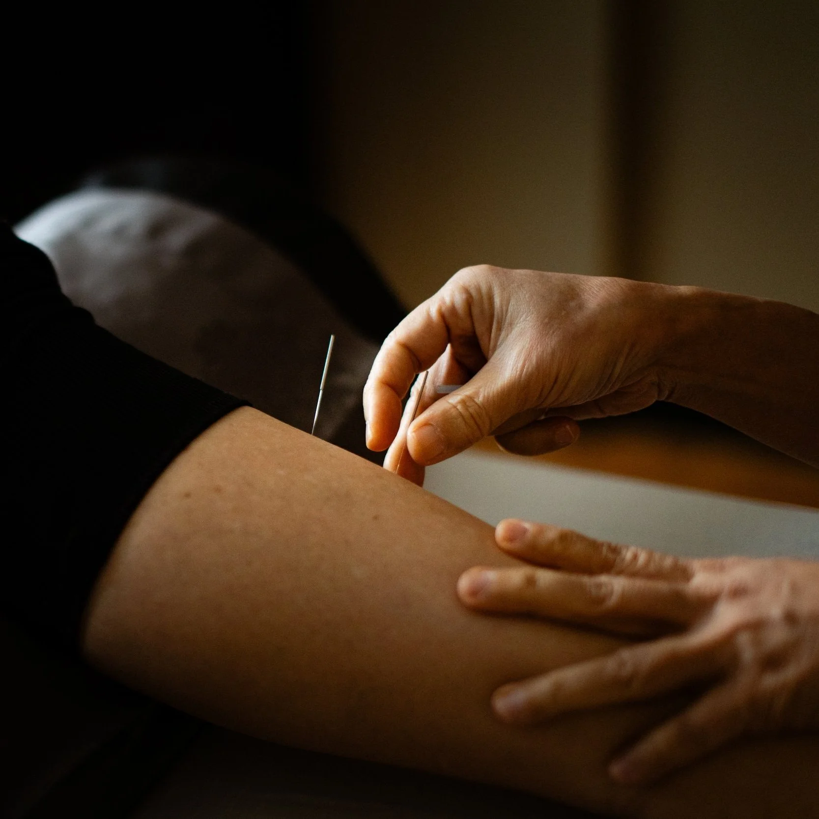 Effective Acupuncture Treatments Using Integrative Methods | Bridge Acupuncture — Bridge Acupuncture