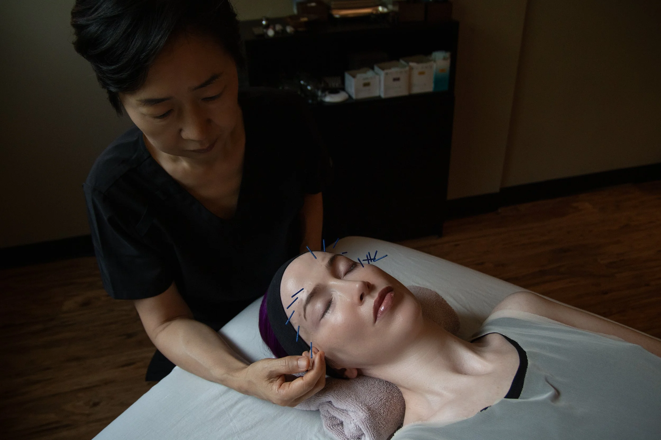 Facial Rejuvenation — Bridge Acupuncture