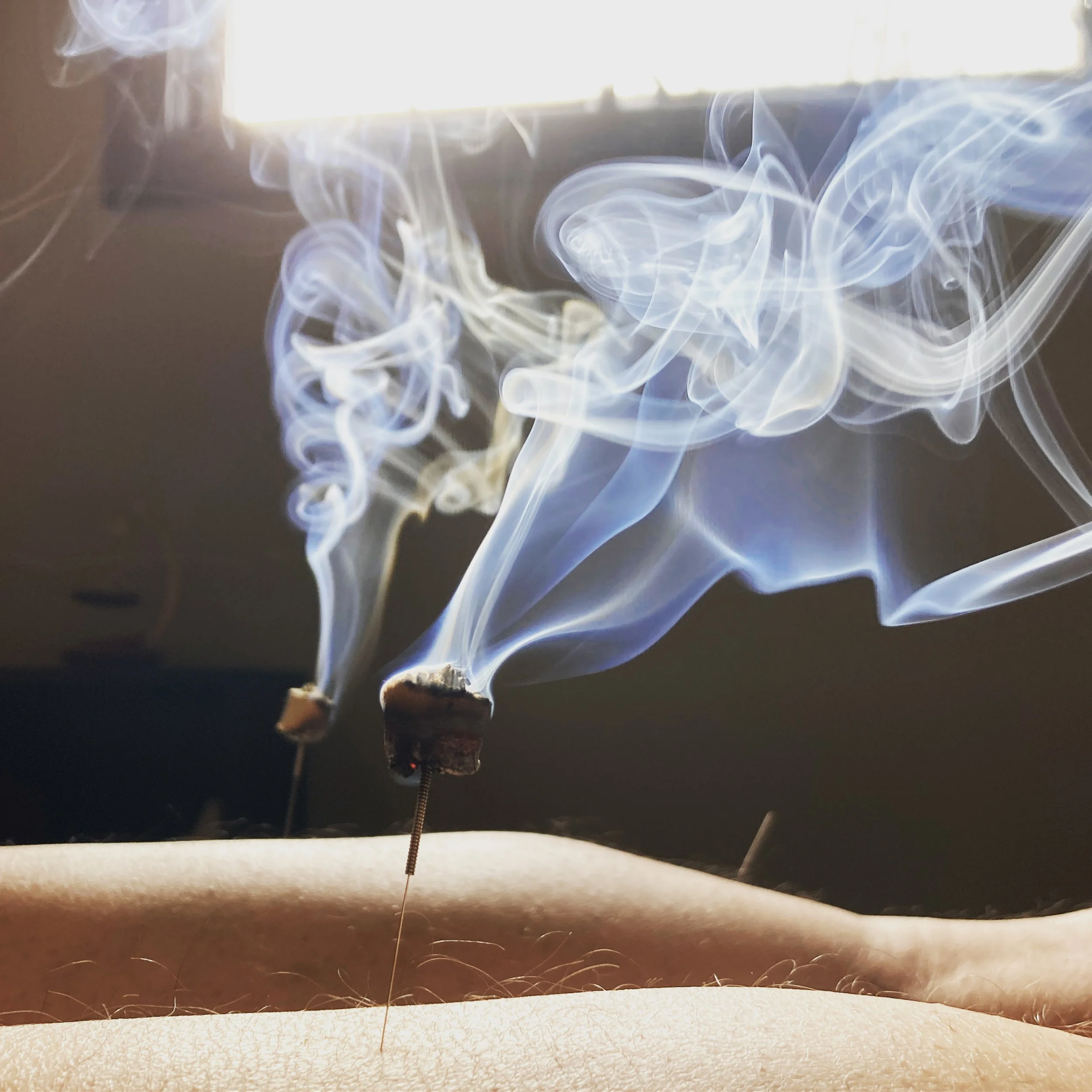 Effective Acupuncture Treatments Using Integrative Methods | Bridge Acupuncture — Bridge Acupuncture