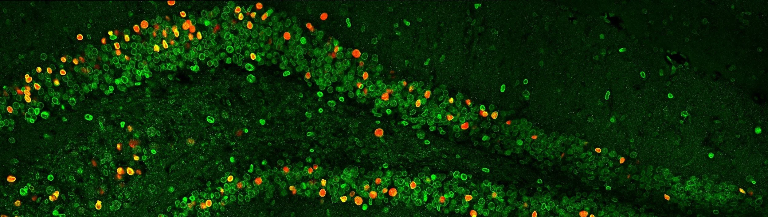 Dileep Laboratory, Genomics and Epigenomics of the Brain, Neurogenomics lab