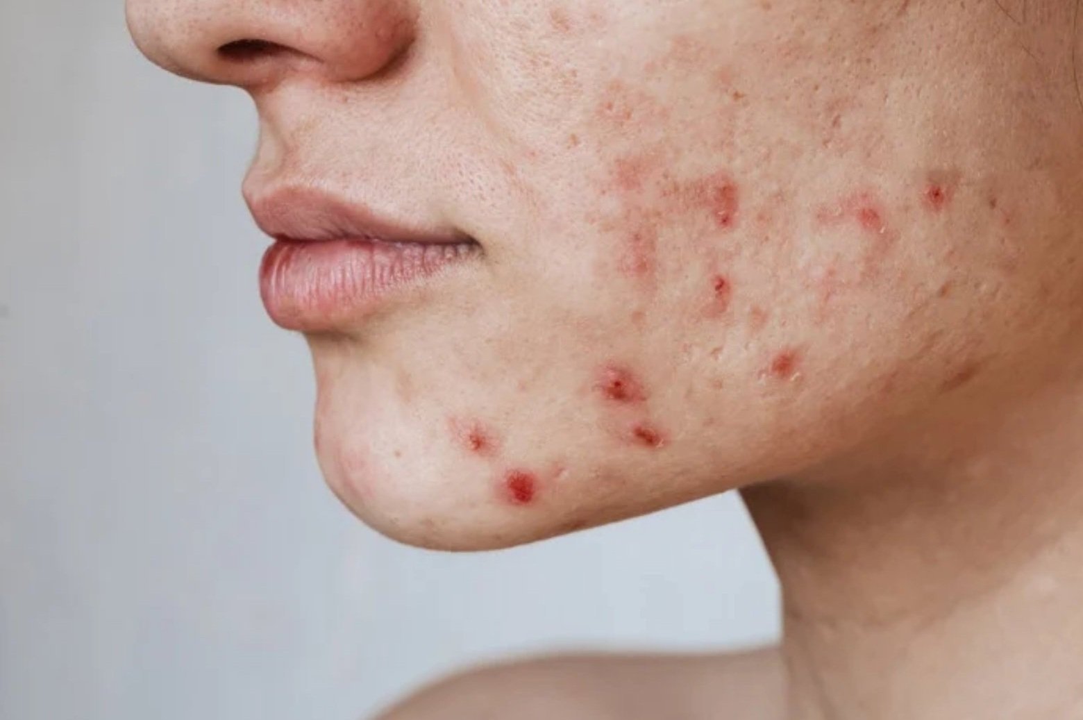 BlueWater Wellness & MedSpa