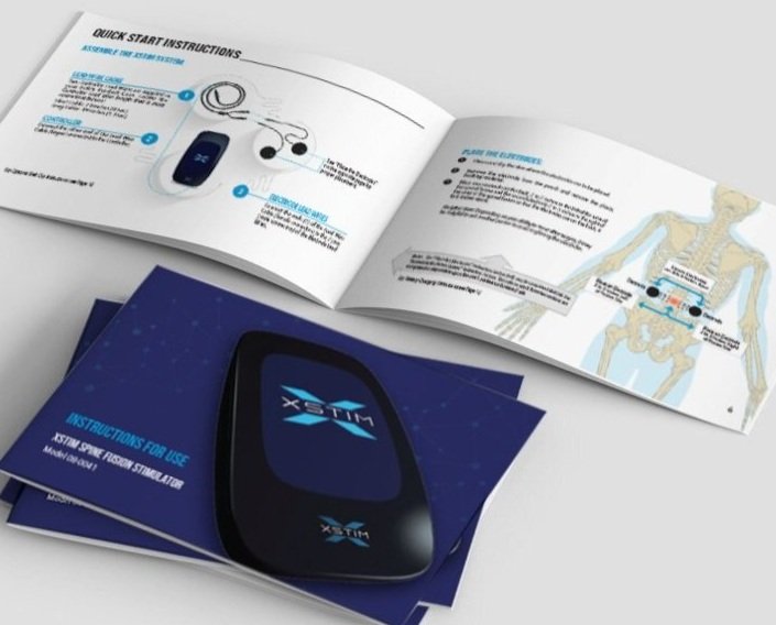 General 2 — Xstim, Spine Fusion Stimulation Therapy