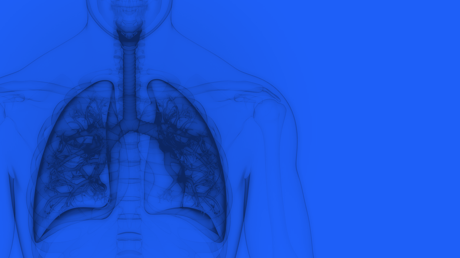 Trace Sensing Technologies