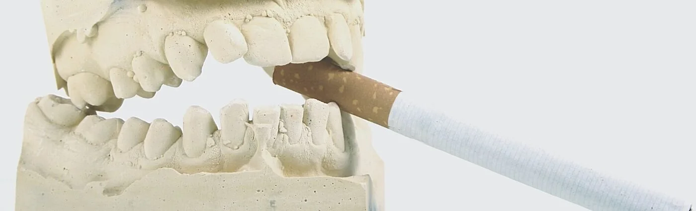 Smoking Versus Teeth — Kingsview Dental Clinic
