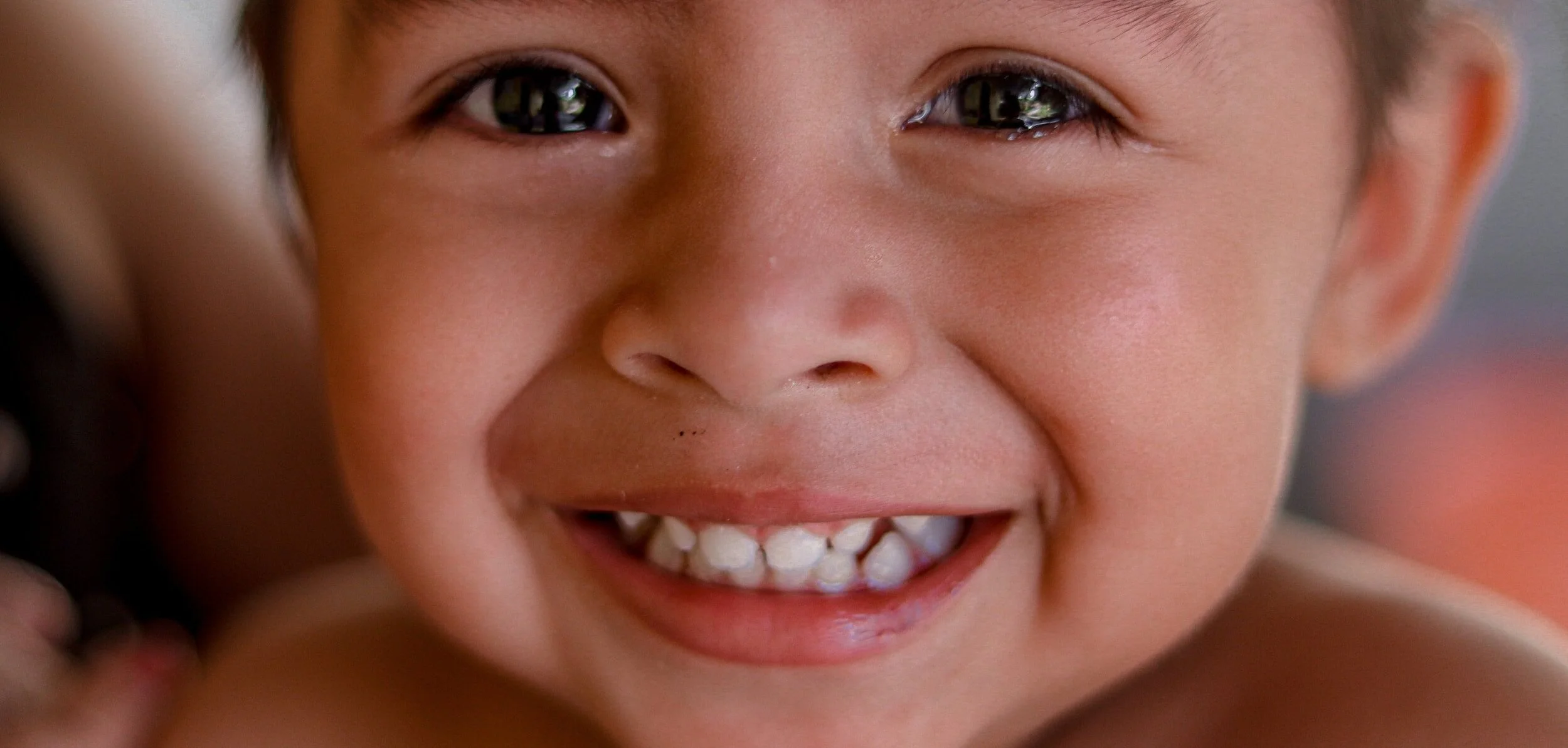 Baby Teeth — Kingsview Dental Clinic