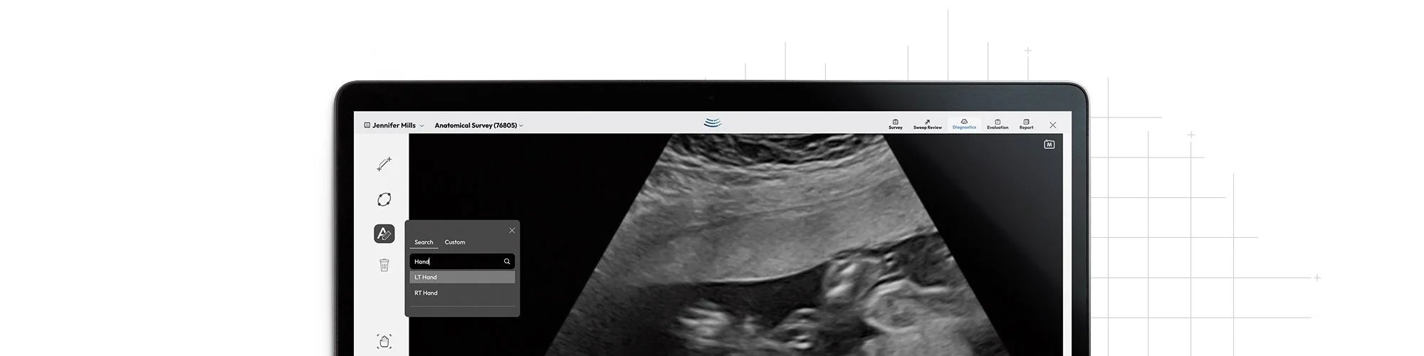 Software — TeleScan