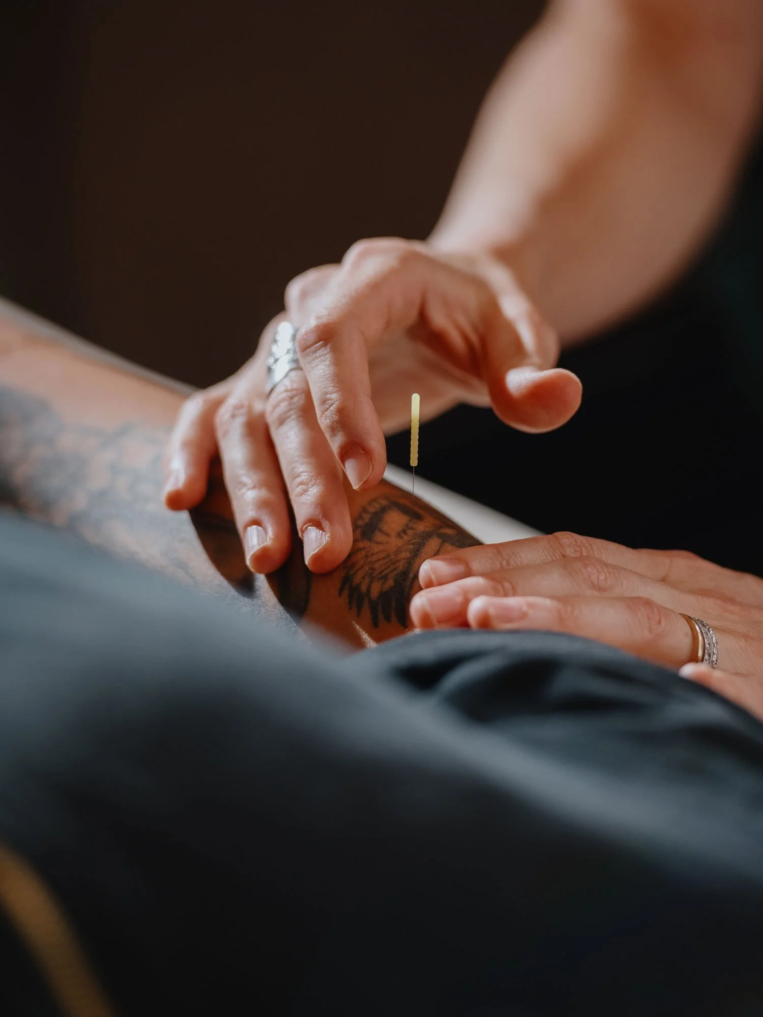 Friendly Neighborhood Acupuncture - Dr. Catherine Vasco