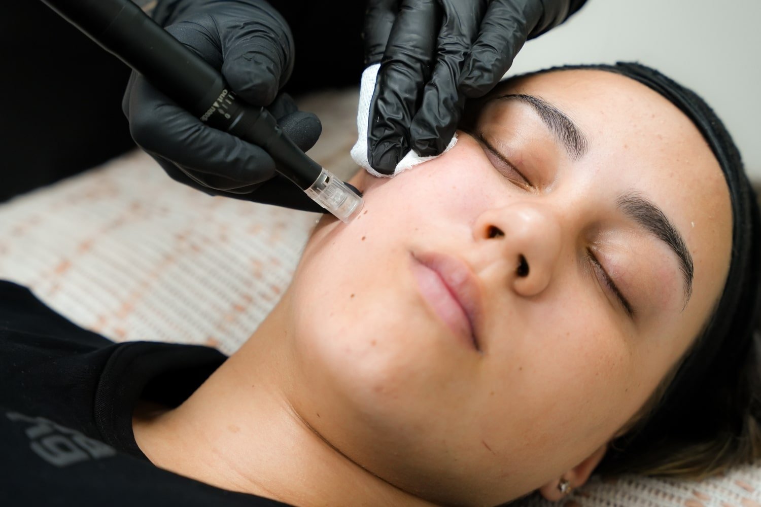 Skin and Beauty Services — Beauty on Boyce – Facial - Derma Needling ...