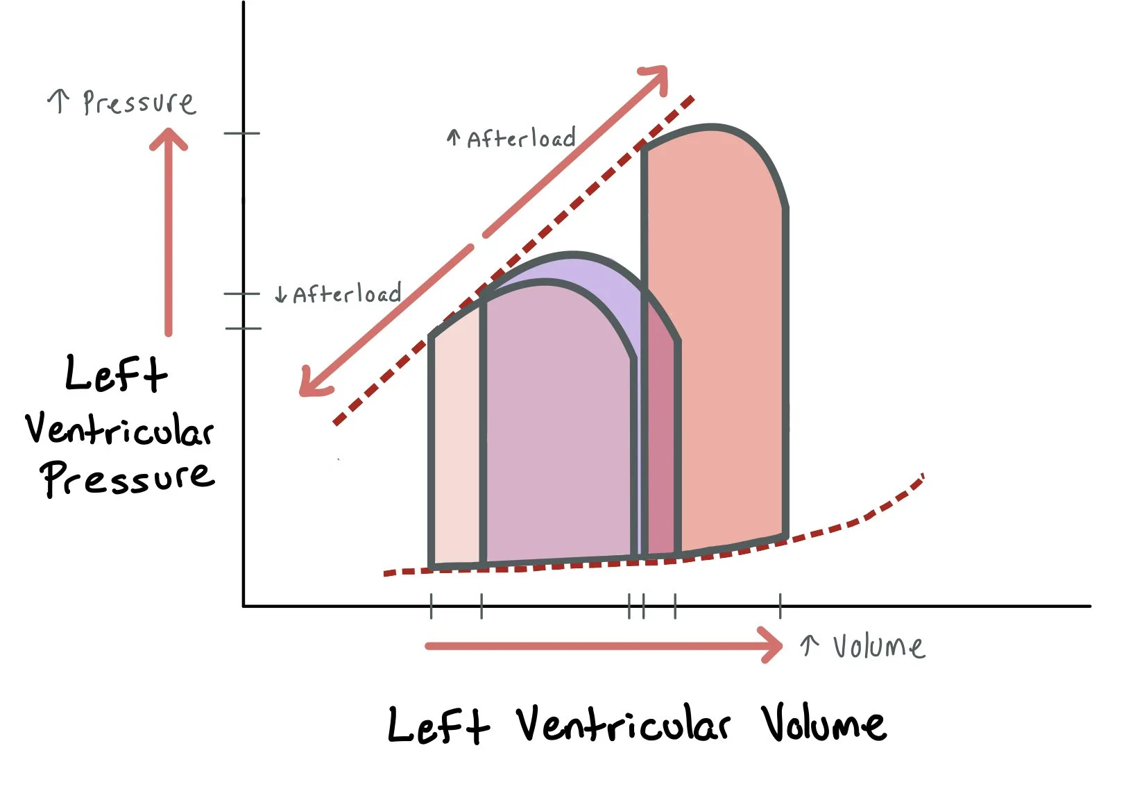 Cardiogenic Shock — When the Beat Drops: A Resident's Guide to the CCU
