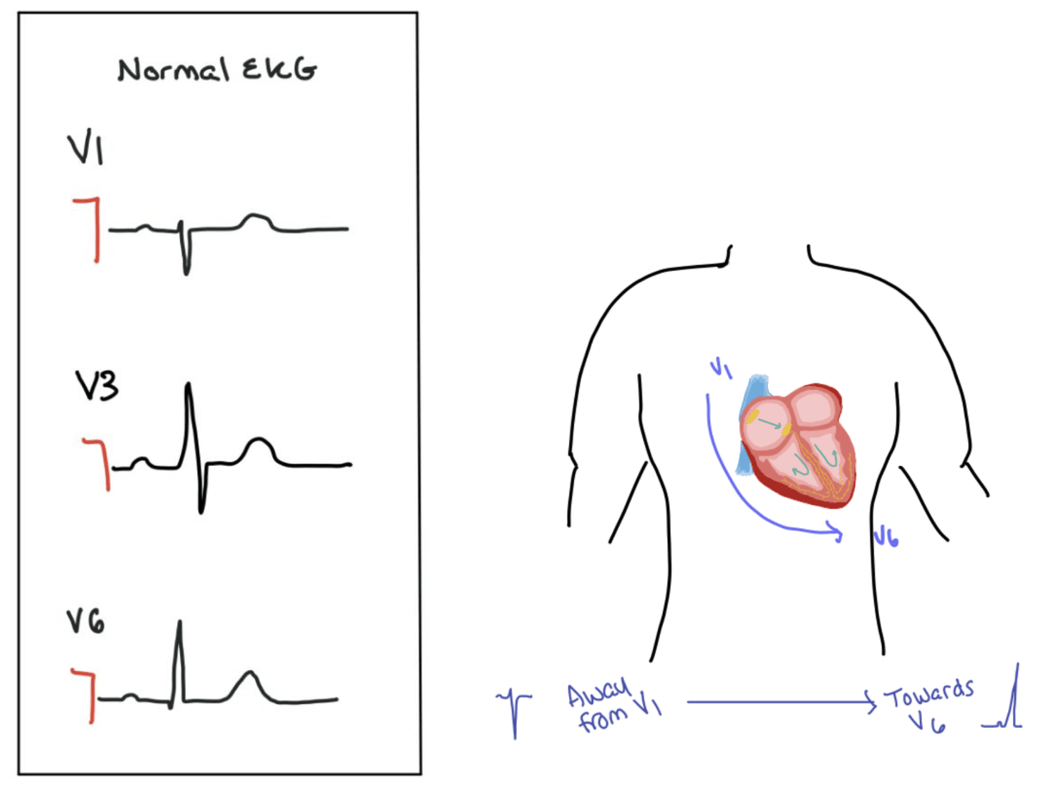 How to Read EKGs — When the Beat Drops: A Resident's Guide to the CCU