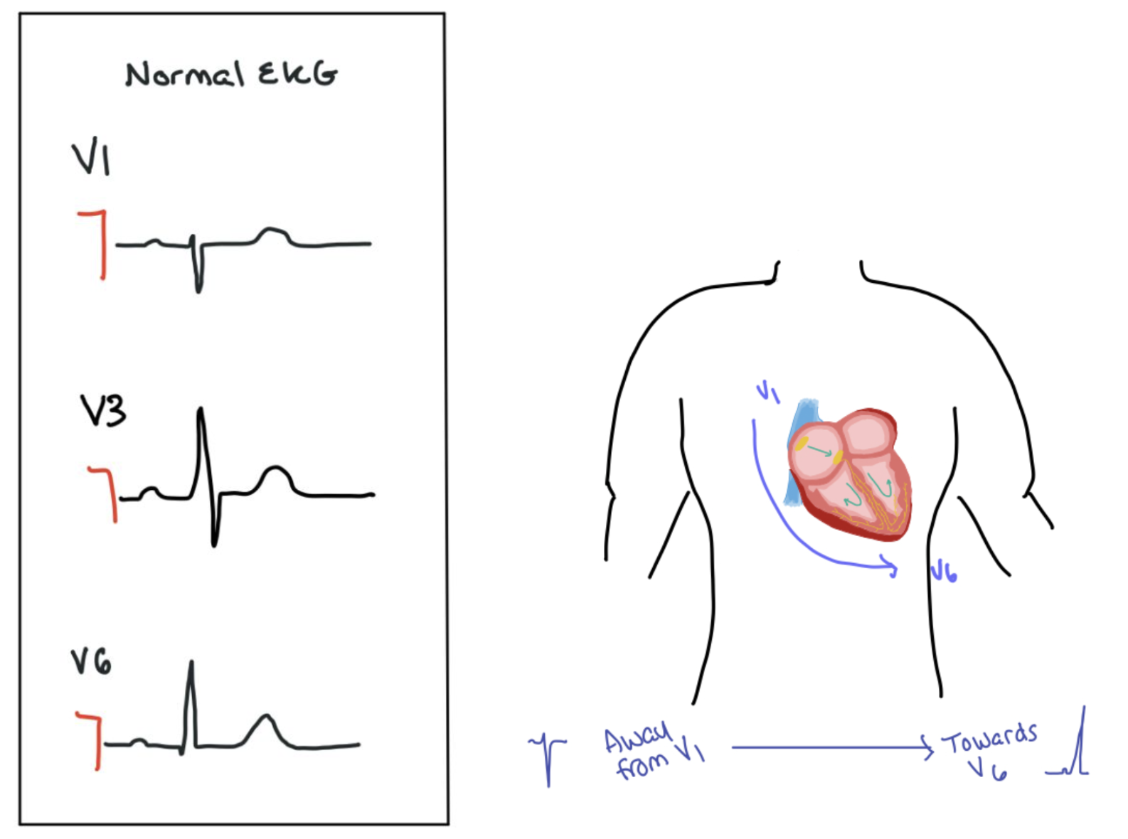 How to Read EKGs — When the Beat Drops: A Resident's Guide to the CCU