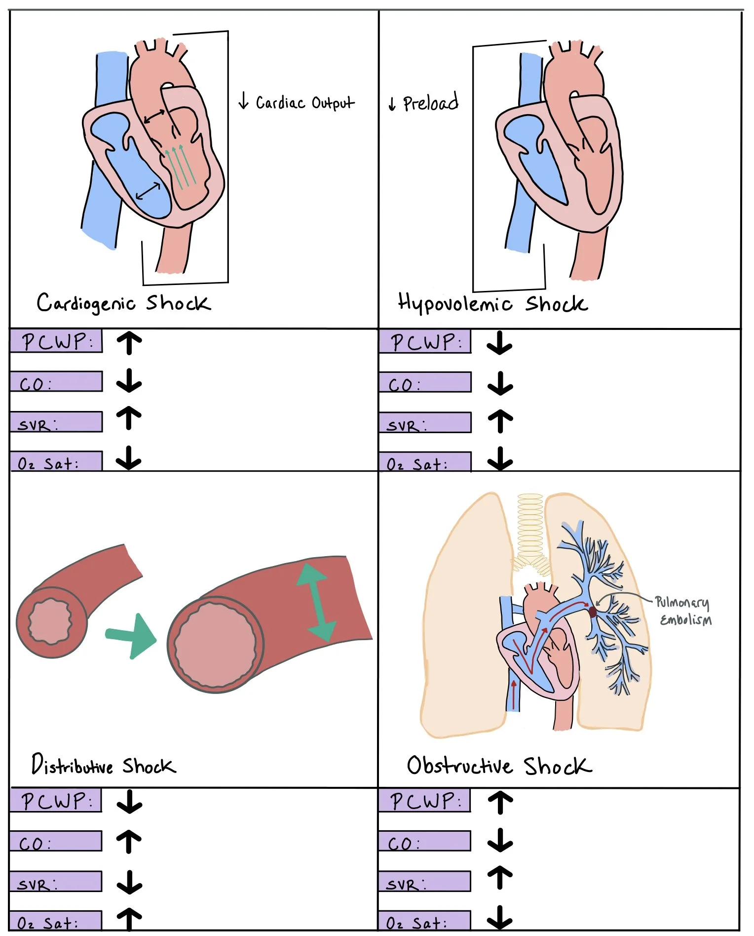 Cardiogenic Shock — When the Beat Drops: A Resident's Guide to the CCU