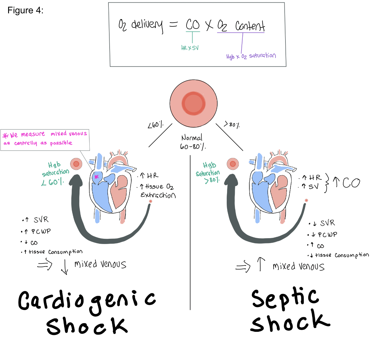 Cardiogenic Shock — When the Beat Drops: A Resident's Guide to the CCU