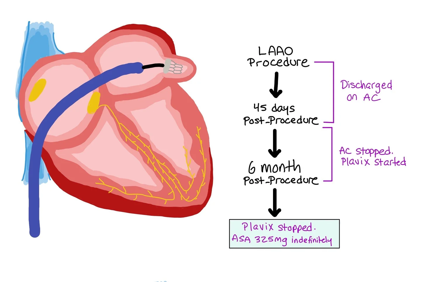 DAPT and GI Bleeds — When the Beat Drops: A Resident's Guide to the CCU