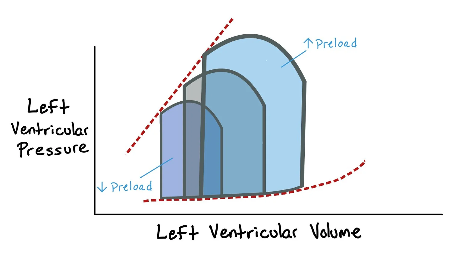 Cardiogenic Shock — When the Beat Drops: A Resident's Guide to the CCU
