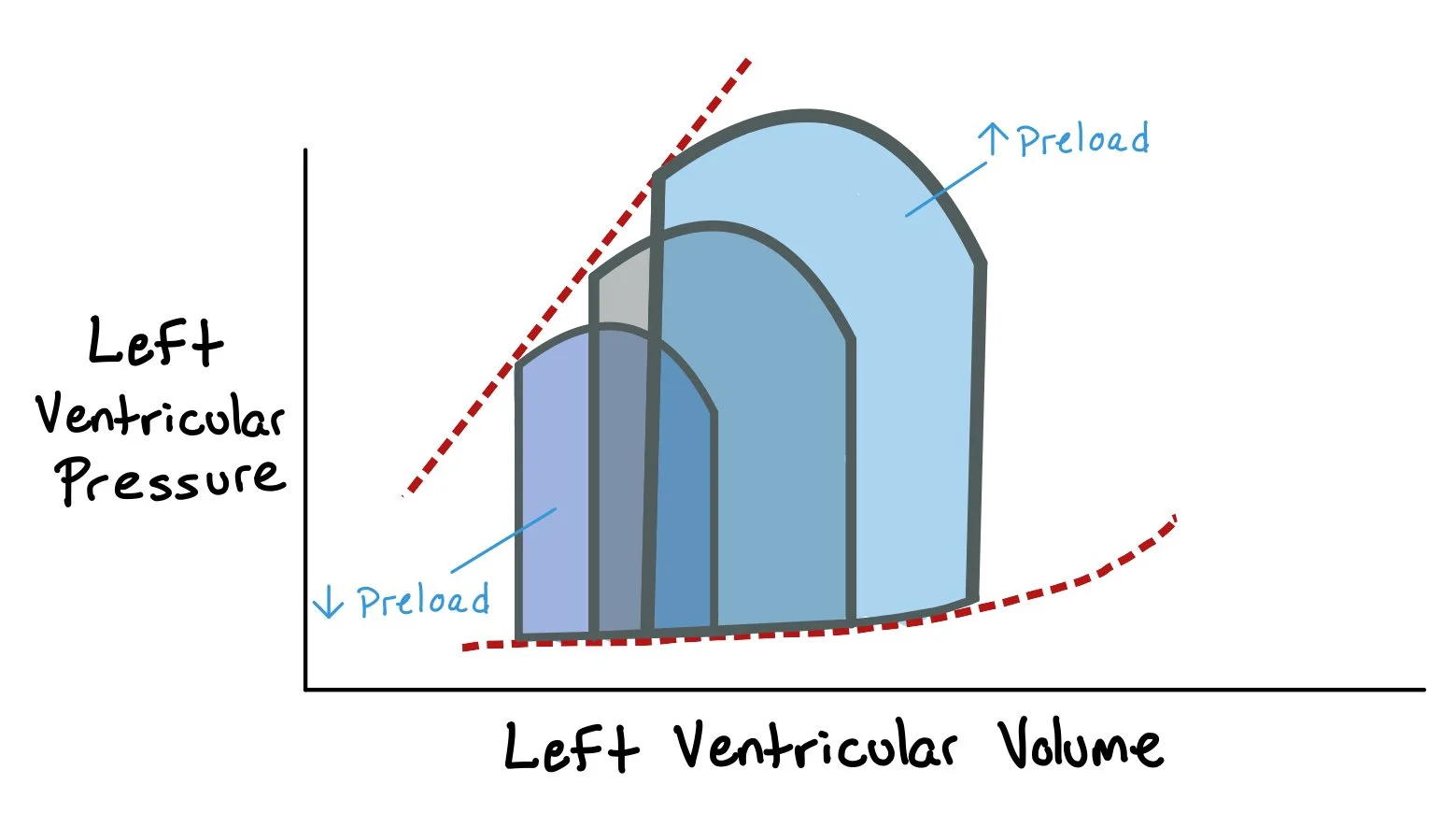 Cardiogenic Shock — When the Beat Drops: A Resident's Guide to the CCU