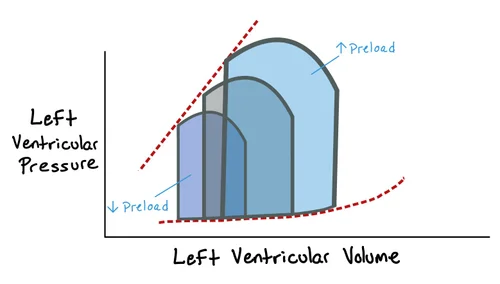 Cardiogenic Shock — When the Beat Drops: A Resident's Guide to the CCU