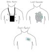Bradycardia — When the Beat Drops: A Resident's Guide to the CCU
