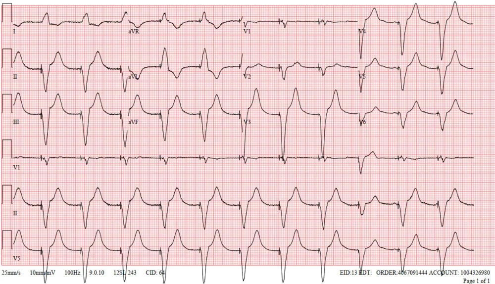 TAVR Complications — When the Beat Drops: A Resident's Guide to the CCU
