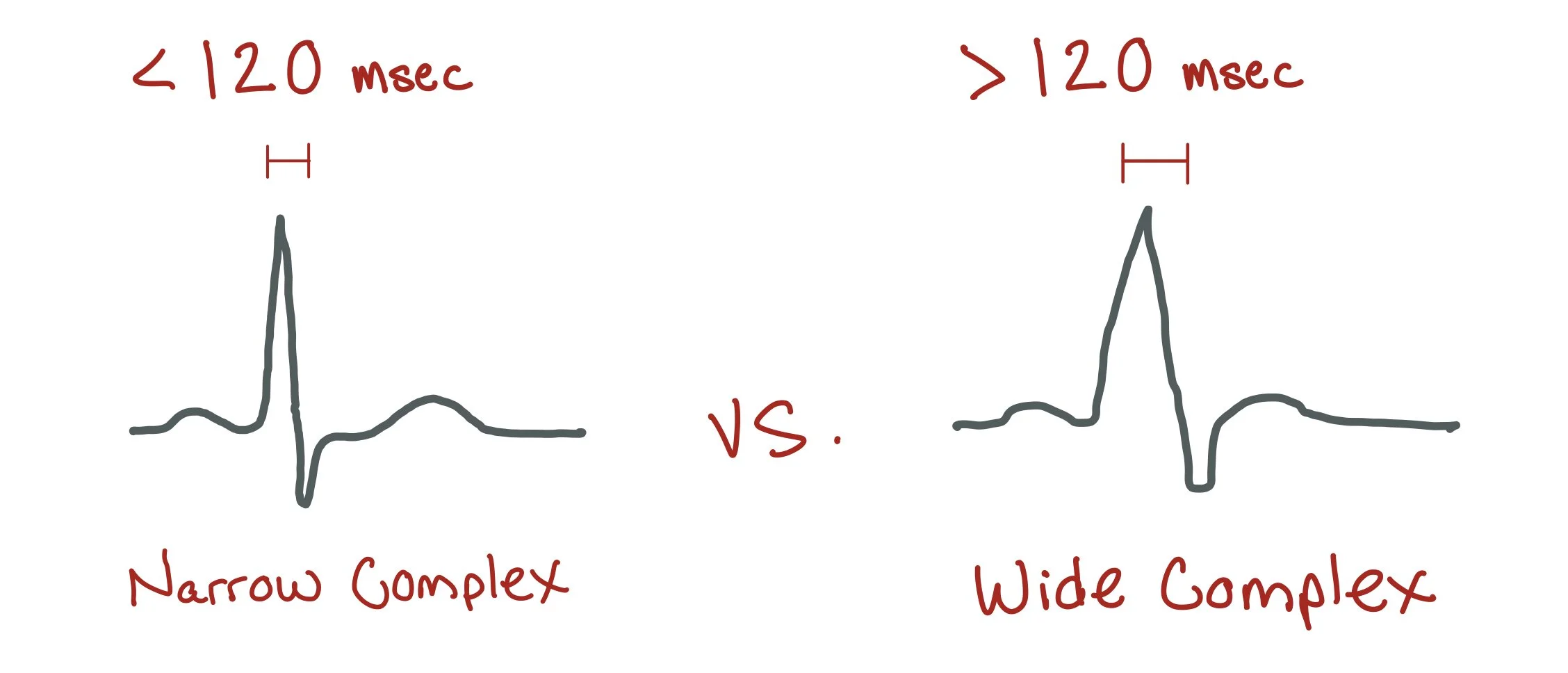 Wide Complex Tachycardia — When the Beat Drops: A Resident's Guide to ...