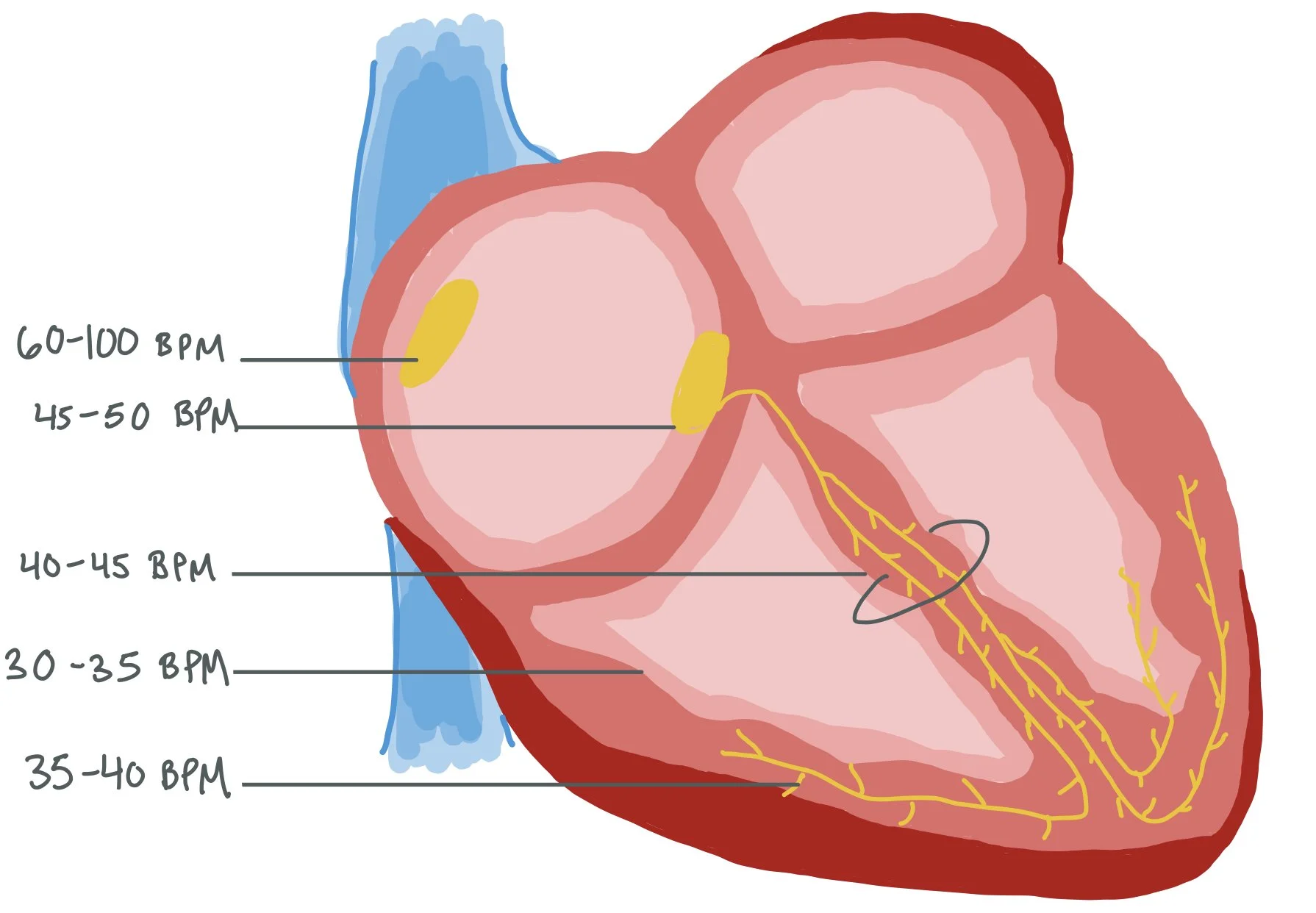 Bradycardia — When the Beat Drops: A Resident's Guide to the CCU